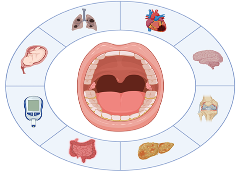 JDR Special Issue: The Relationship Between Oral and Systemic Diseases ... JDR Special Issue: The Relationship Between Oral and Systemic Diseases ...